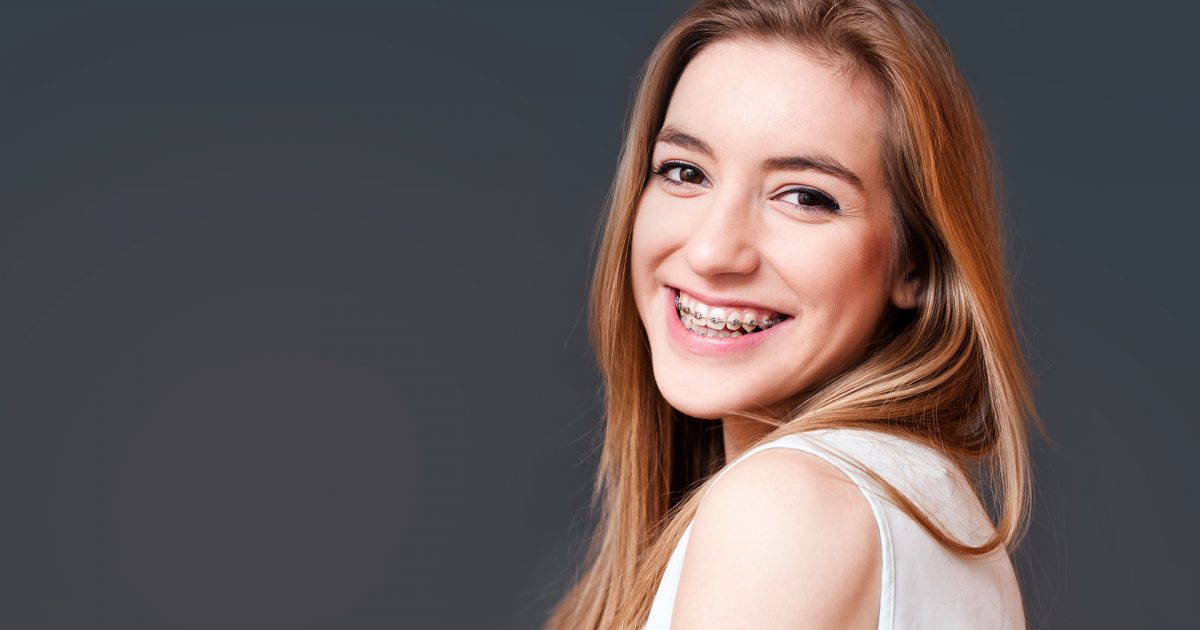 Fixed Braces | Teeth Straightening | Portman Smile Clinic